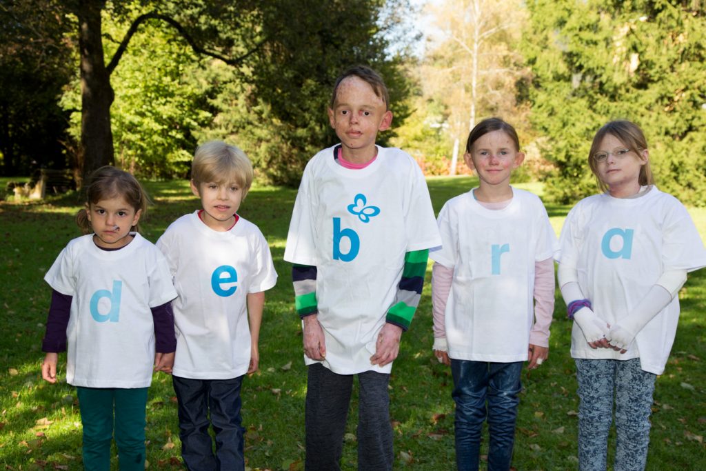 Austrian EB Patient Inspires Dad to Establish World's 1st 'EB House'